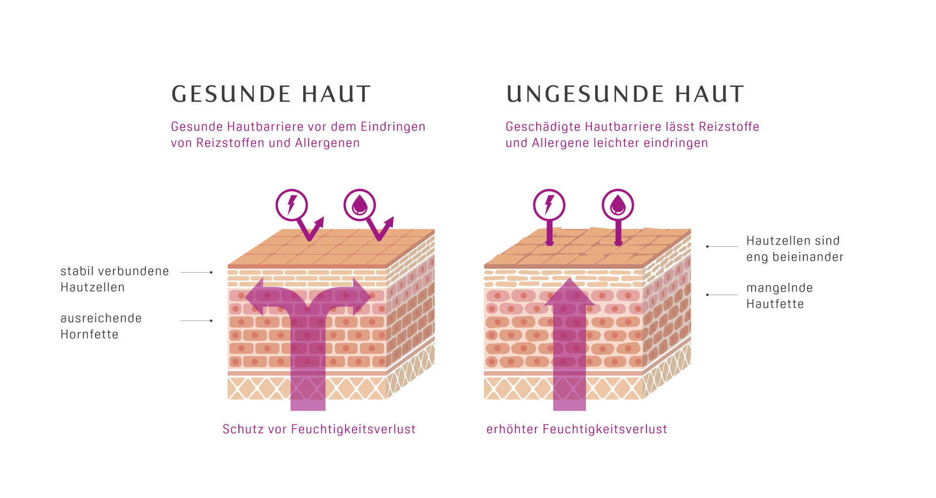 Akuter Schub bei Neurodermitis: Auslöser & Behandlung